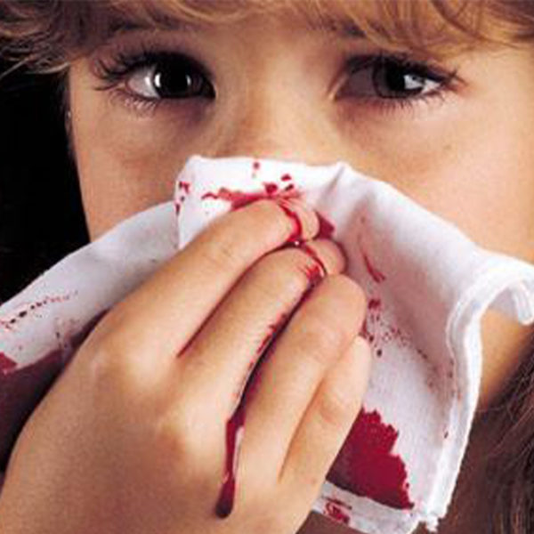 Rhino Rocket for Nosebleeds, PVA Expandacell Foam - Penn Care, Inc.