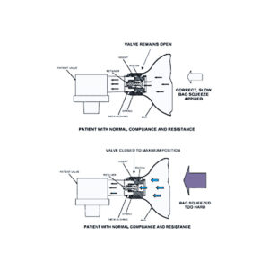 BVM, Smart Bag w/ Inflated Cuffed Mask, Oxygen Reservoir & Tubing ...