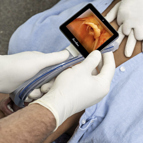 Video Laryngoscope, Ambu, SureSight, - Penn Care, Inc.